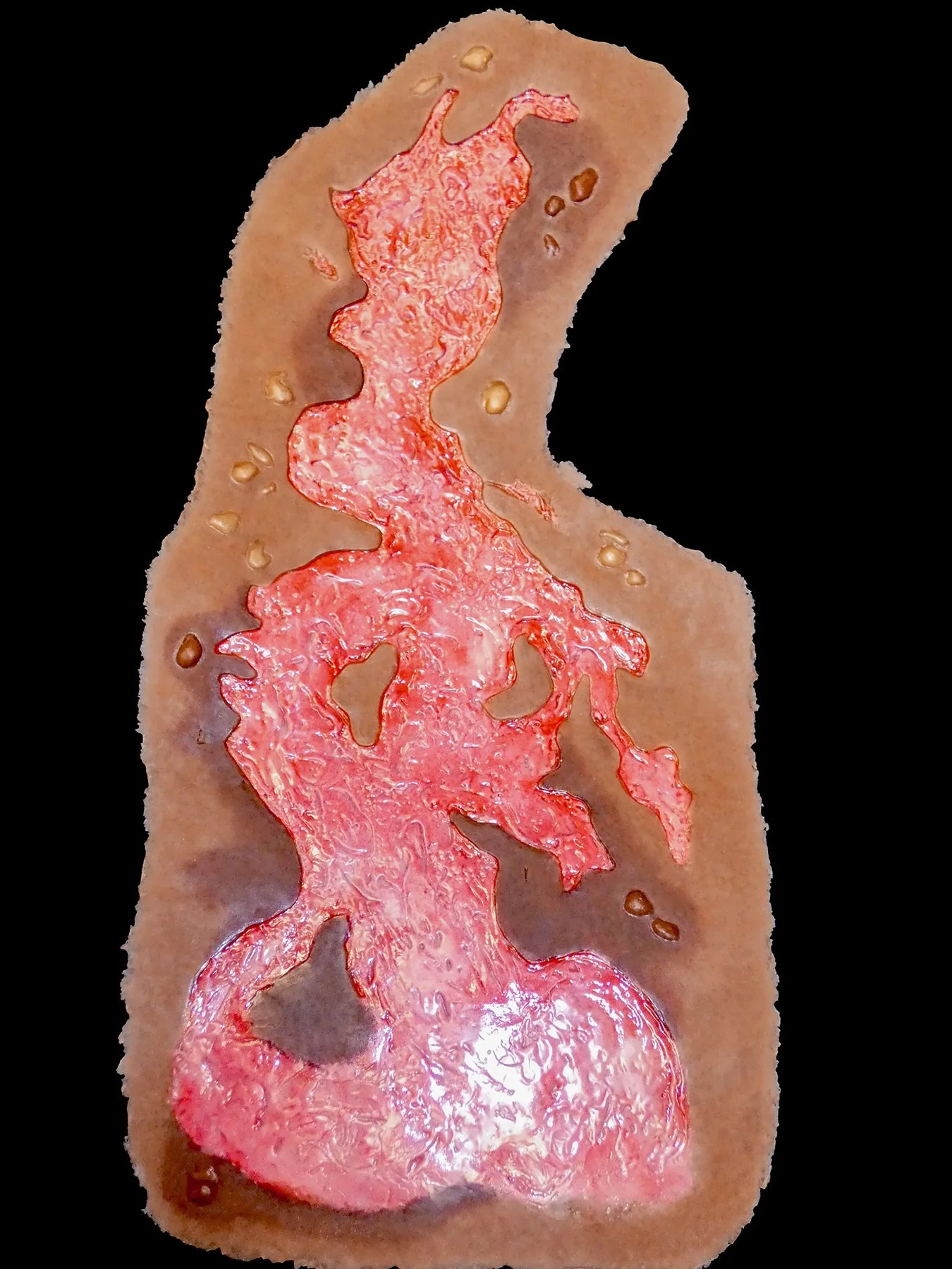 Chest Burn Full Debrided - Joint Force Tactical